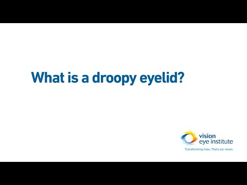 What is a droopy eyelid?