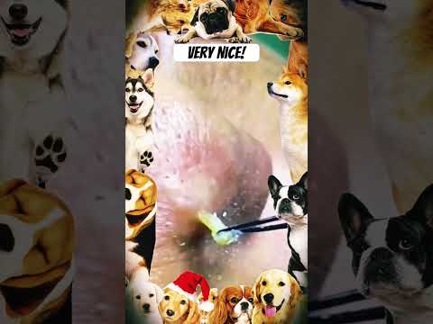 Wow! #pimplepopping #pimple #pimples #shortsfeed #shortvideo #shorts #short #youtube #youtubeshorts