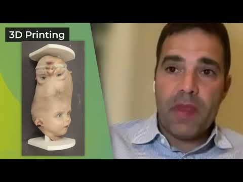 30 Years of Separating Conjoined Twins — Video Discussion by Oren M. Tepper, MD
