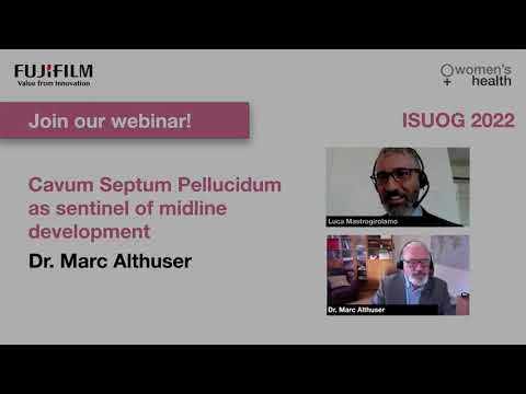 ISUOG 2022 Webinar - Cavum Septum Pellucidum as sentinel of midline development (Dr Marc Althuser)