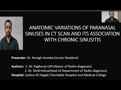 Amogh Anvekar ANATOMICAL VARIATIONS OF THE PARANASAL SINUSES AND ITS ASSOCN WITH CHRONIC SINUSITIS