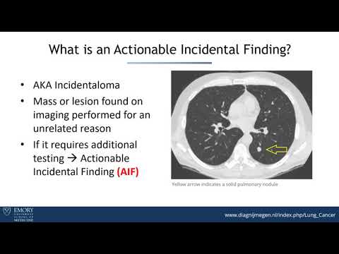 Managing Incidental Findings