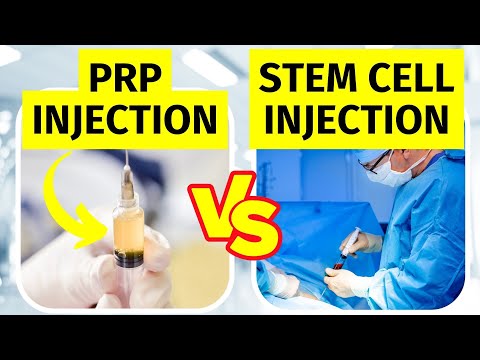 PRP Injection vs Stem Cell Therapy for Knee Arthritis