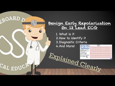 Benign Early Repolarization On Actual 12 Lead ECG - Identifying, Diagnostic Criteria, And More!