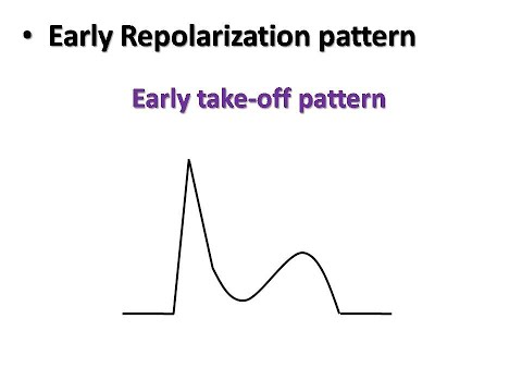 ECG course: STEMI or Early Repolarization Pattern? Dr. Sherif Altoukhy