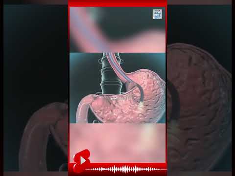#shorts | Endoscopy பற்றி தெரிஞ்சுக்கலாமா! | @hindutamilthisai