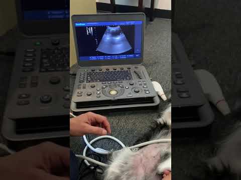 Sonoscape Digital Portable Ultrasound