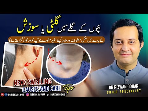 Unlock the Secrets of Neck Swelling in Kids: Expert Insights #neckswelling #lymphnodes #treatment