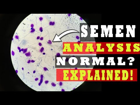 What is Semen Analysis Test | Procedure, Normal & Abnormal Report [EXPLAINED!]