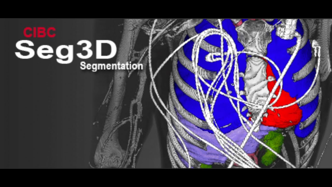 Seg3D Tutorials Ventricles