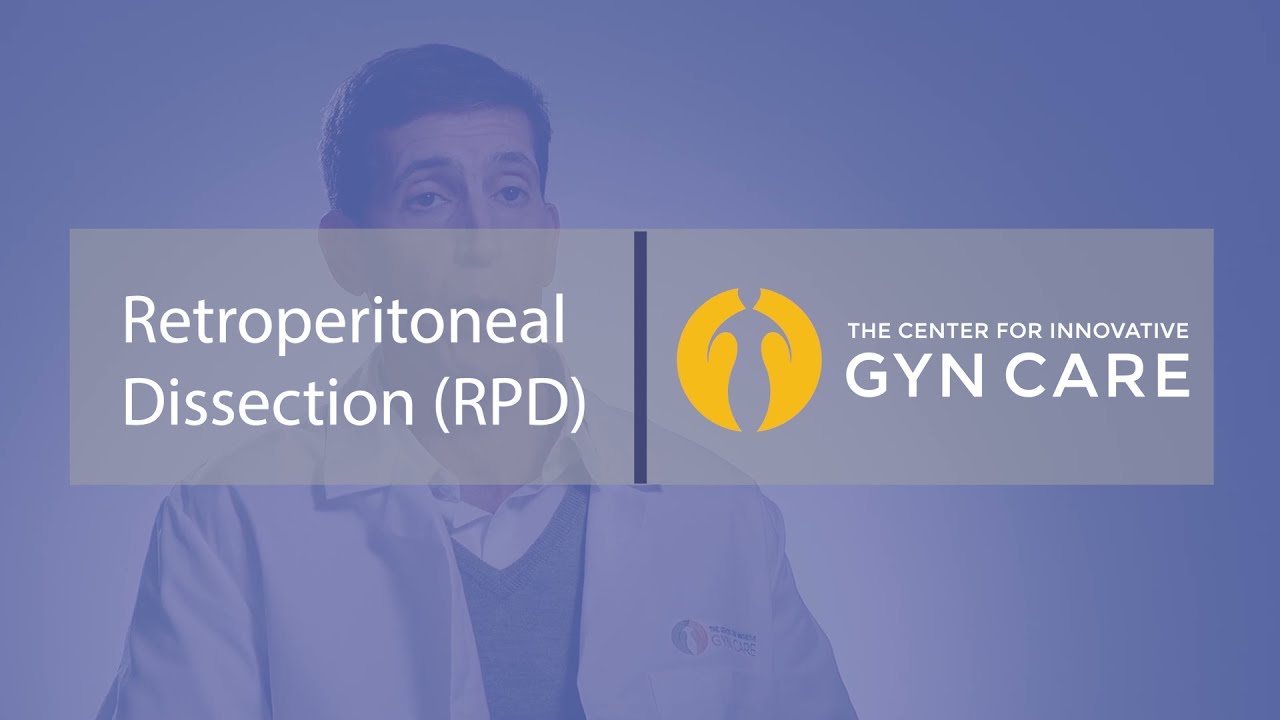 CIGC's Retroperitoneal Dissection