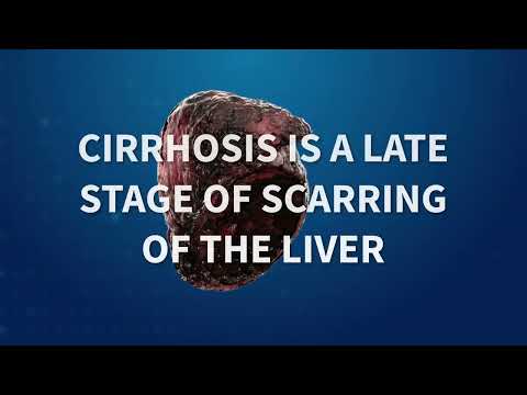 Cirrhosis of the Liver