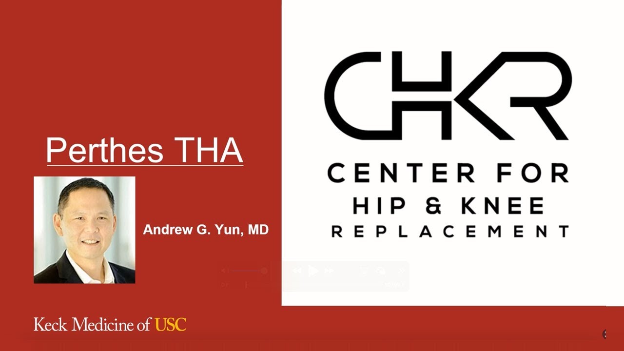 Perthes Total Hip Arthroplasty (THA)