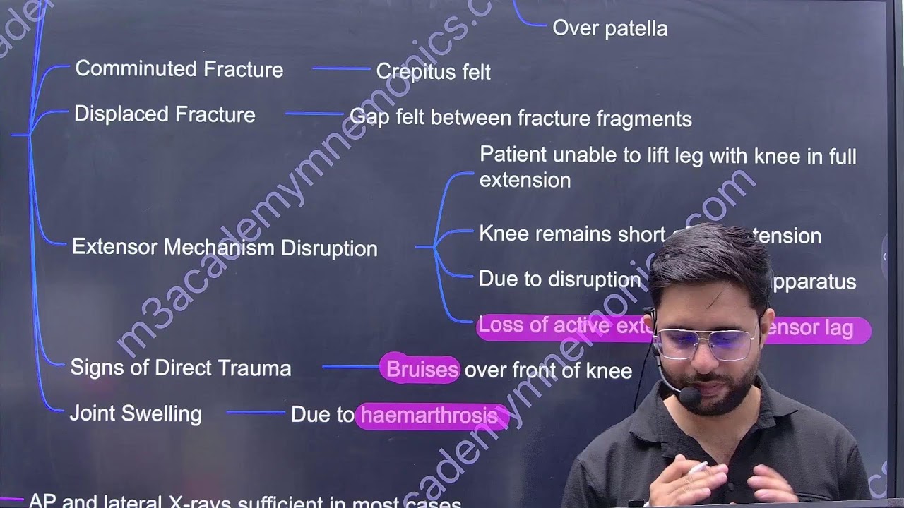 Patella Fracture Mind Map Orthopedics — PYT Priority Program