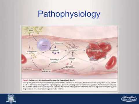 Thrombocytopenia in the ICU