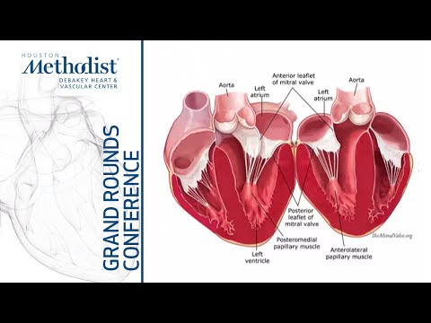 Transcatheter Mitral and Tricuspid Interventions: State of the Art (Sachin Goel, MD) March 19, 2020