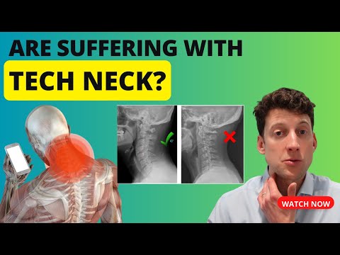 What is "tech neck" and how to FIX it?