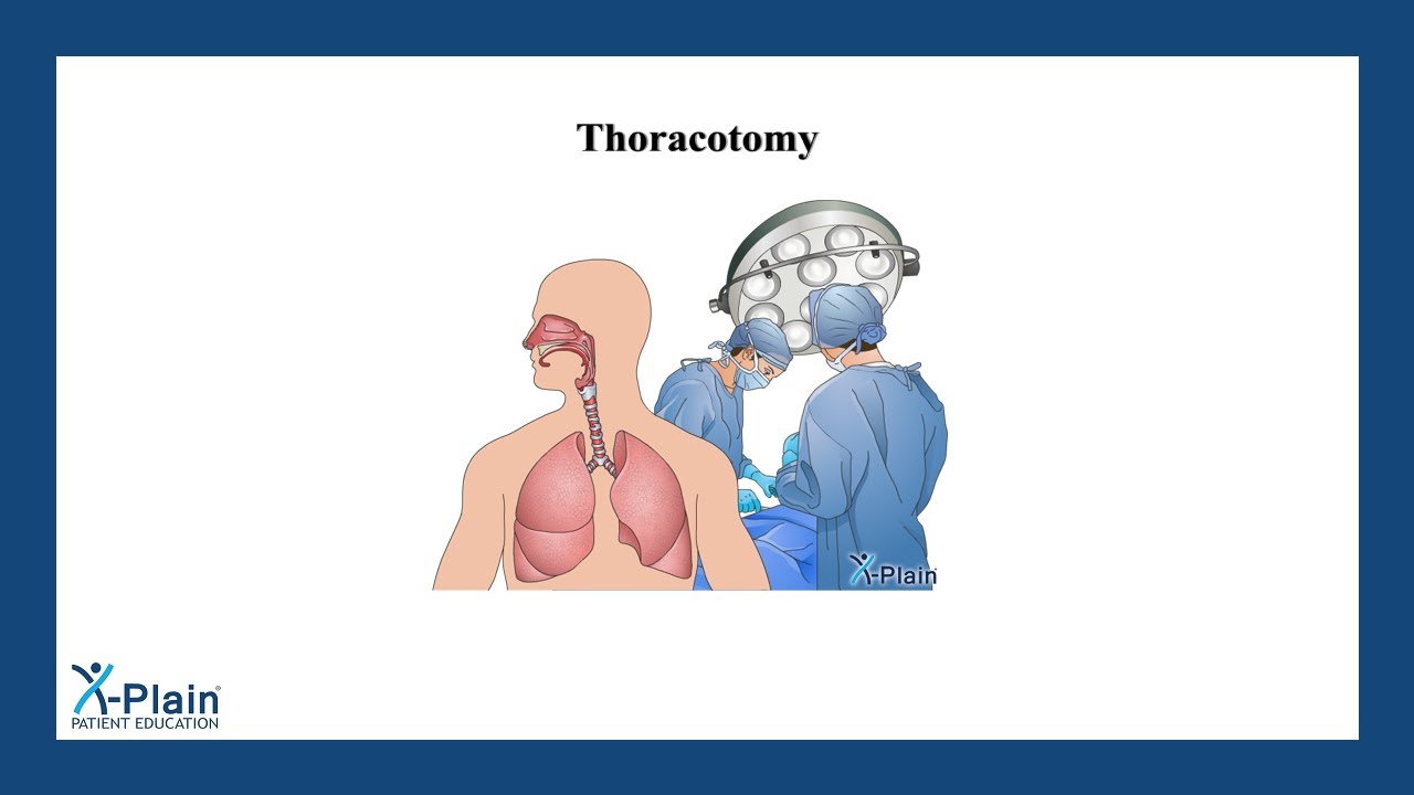Thoracotomy