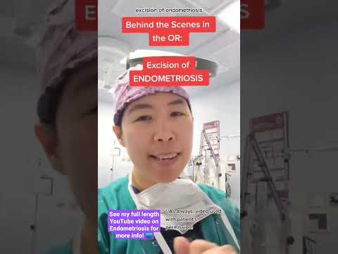 Laparoscopic excision of endometriosis - SURGERY video! How do we diagnose and treat endo?