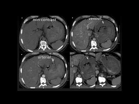 CT Protocol Essentials
