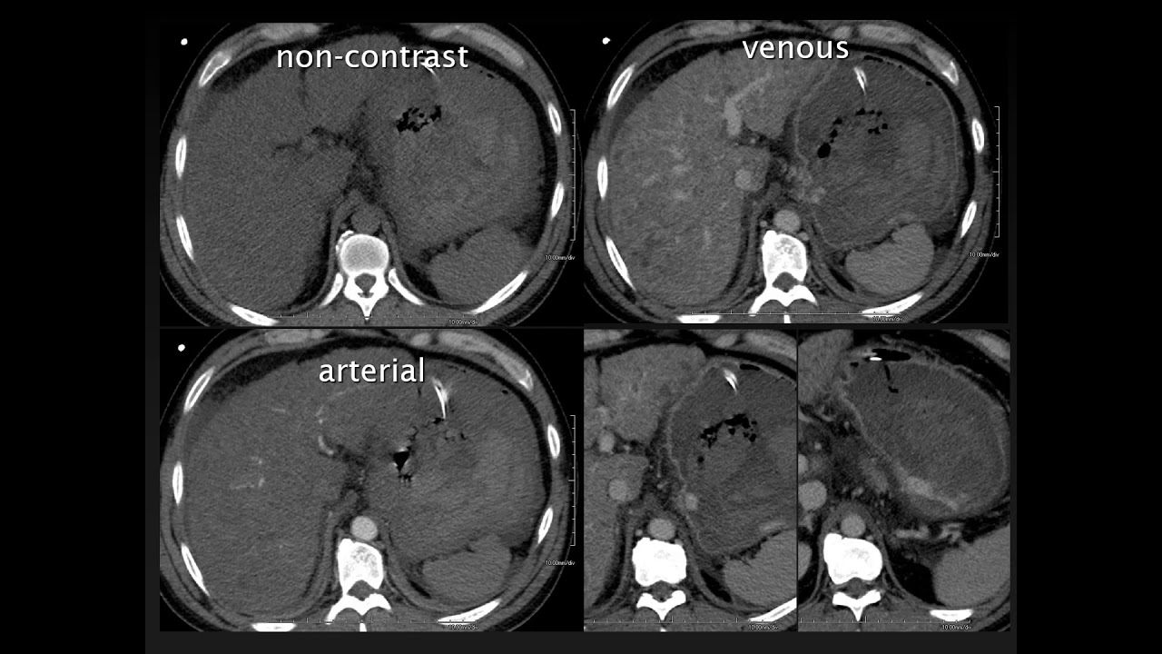 CT Protocol Essentials