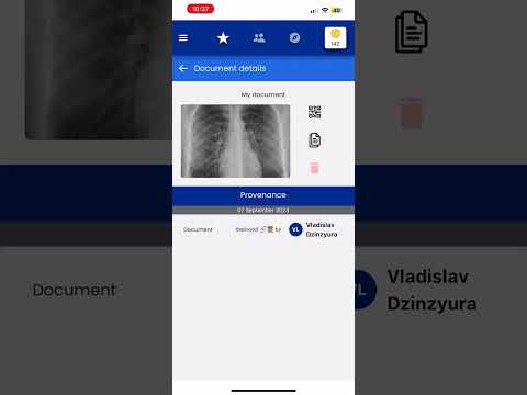 (old UI) document upload example