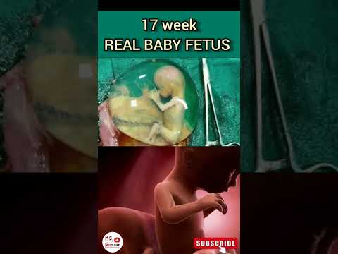 17 week real baby Fetus 👶🏻❤️ your baby at 4 months pregnant #shortsfeed #pregnancy