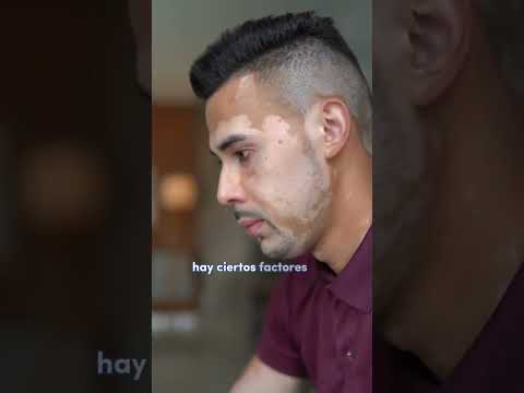 ¿POR QUÉ SE PRODUCE EL VITILIGO Y QUIÉNES SON MÁS PROPENSOS?
