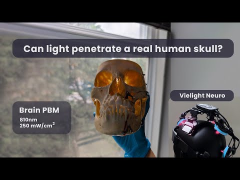 Real Skull Test: NIR Light Penetration Using the Vielight Neuro for Brain PBM