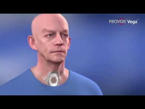 A ’bionic’ larynx sounds far more natural than regular artificial voice ...