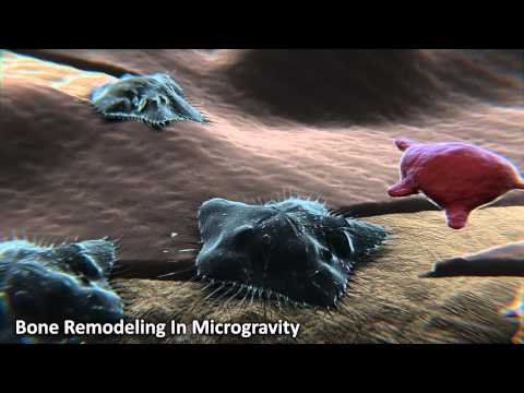 Bone Remodeling in Microgravity
