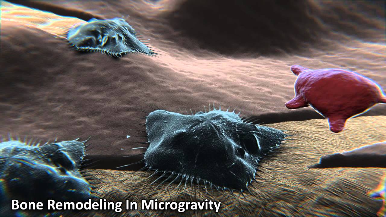 Bone Remodeling in Microgravity