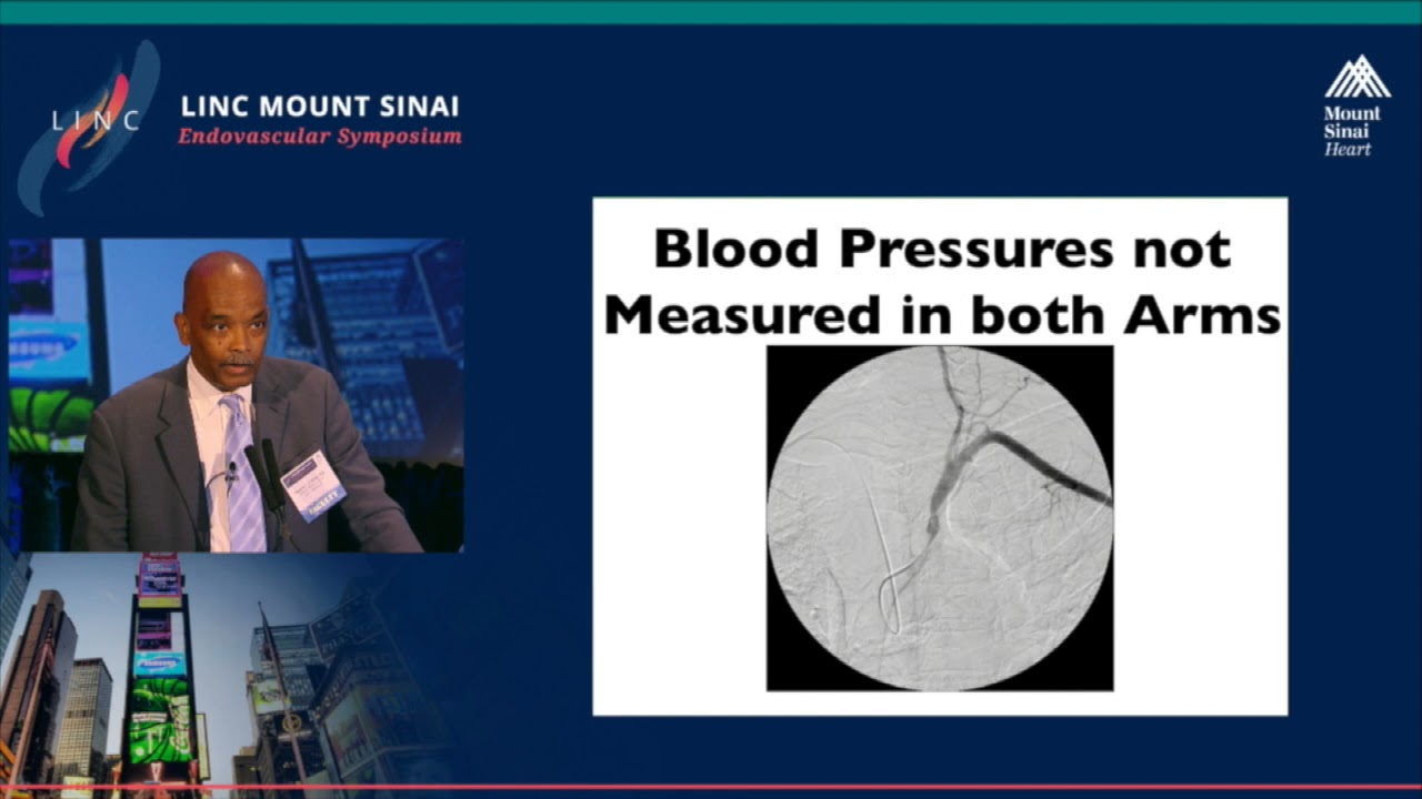 My Algorithm for Subclavian Artery Interventions