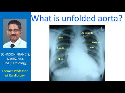 What is unfolded aorta?