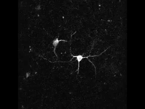 Dendritic Imaging with GCaMP6s in Awake Monkey