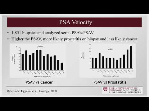 AUA Guidelines on Early Detection of Prostate Cancer Webcast (2025)