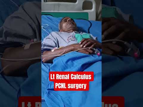 How They Remove Your Kidney Stones (Surgery Explained)