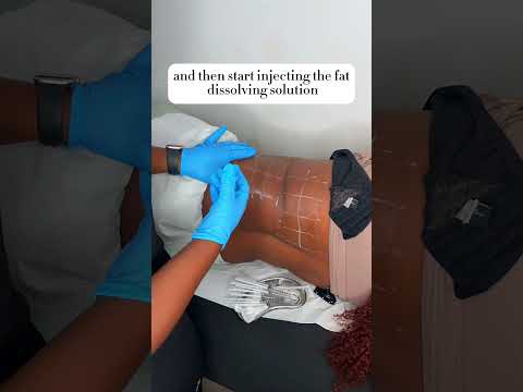 Fat Dissolving Injections | How It’s Done | #FatDissolving | How To Reduce Stubborn Fat