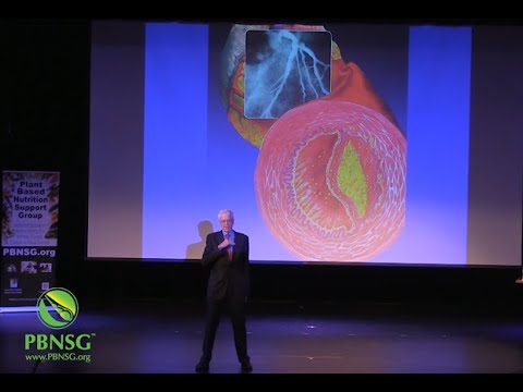 Treating the Cause to Prevent and Reverse Heart Disease with Dr. Caldwell Esselstyn