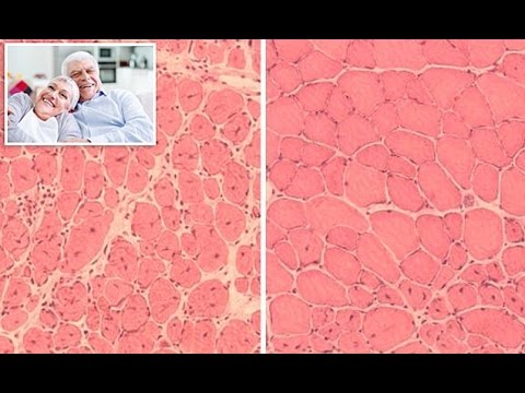 Life expectancy could leap to 108 with controversial cell rejuvenation technique