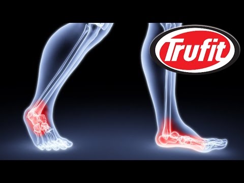 Mid-Foot Arthritis Relief and Treatment