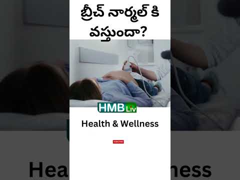 బ్రీచ్ నుంచి నార్మల్ కి వచ్చే అవకాశం ఎంత ఉంది?| Breech to normal : | HMBLiv Health & Wellness |