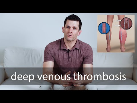 deep venous thrombosis
