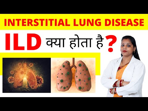 Interstitial Lung Disease (ILD) - Causes, Symptoms, Diagnosis, Treatment | Dr. Kanchan Singh