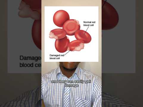 Lets learn about G6PD Deficiency #mrbeast #nursingstudent #likenastyavlogs #setindia #trend #tseries