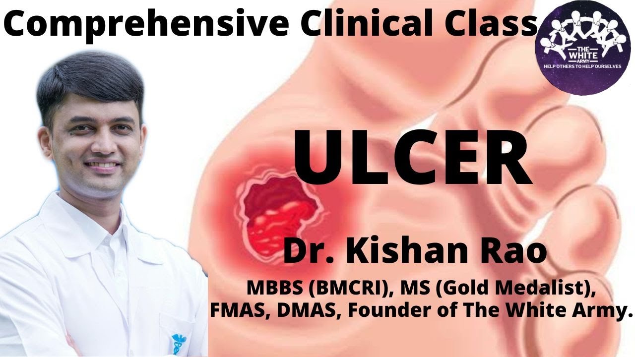 Ulcer Case Presentation