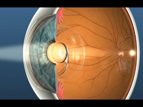 Got Cataracts? See Near, See Far and See Up Close with Trifocal PanOptix IOL.