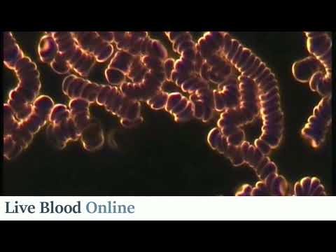 What Causes Red Blood Cells to Stick Together (rouleau) - Live Blood Analysis Training Course