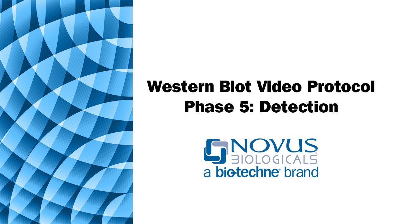 Western Blot Visual Protocol: Phase 5: Detection