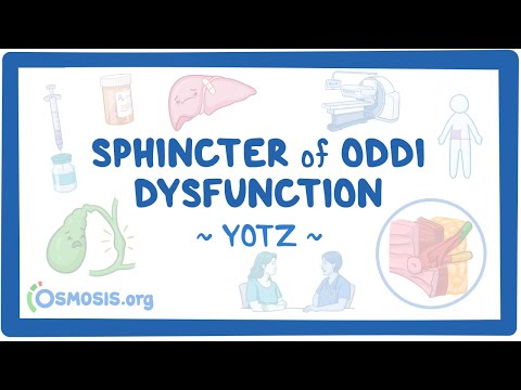 Sphincter of Oddi dysfunction (Year of the Zebra 2024)